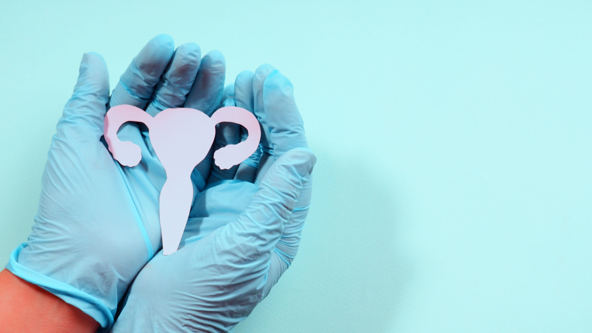 Polycystic ovary syndrome: causes, symptoms, diagnosis and treatment